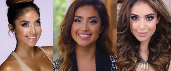 Dulce Candy Plastic Surgery Before and After Pictures 2025