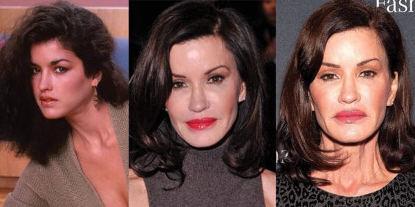Janice Dickinson Plastic Surgery Before And After Pictures 2024
