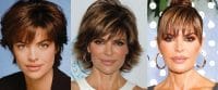 Lisa Rinna Plastic Surgery Before and After Pictures 2025
