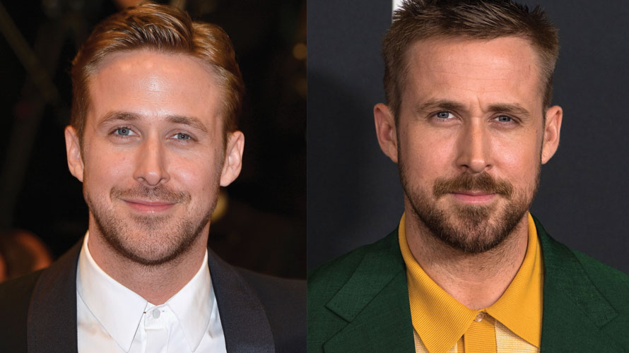 Rhinoplastie De Ryan Gosling Rhinoplastie De Ryan Gosling