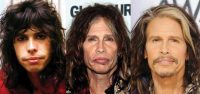 Steven Tyler Plastic Surgery Before and After Pictures 2025