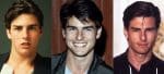 Tom Cruise Plastic Surgery Before and After Pictures 2025